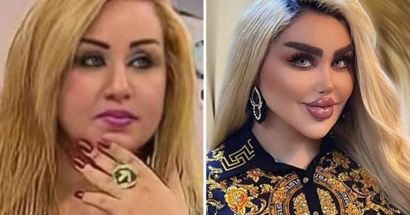 Esta garota passou por 45 cirurgias para se transformar em uma Barbie ...
